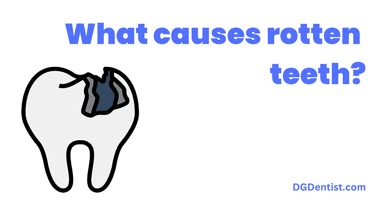 Rotten Teeth: Causes, Symptoms & Treatment - DG Dentist