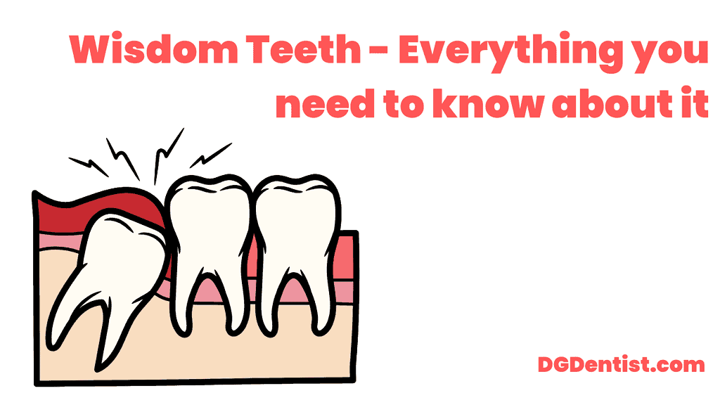 Wisdom Teeth - Everything you should know about it - DG Dentist